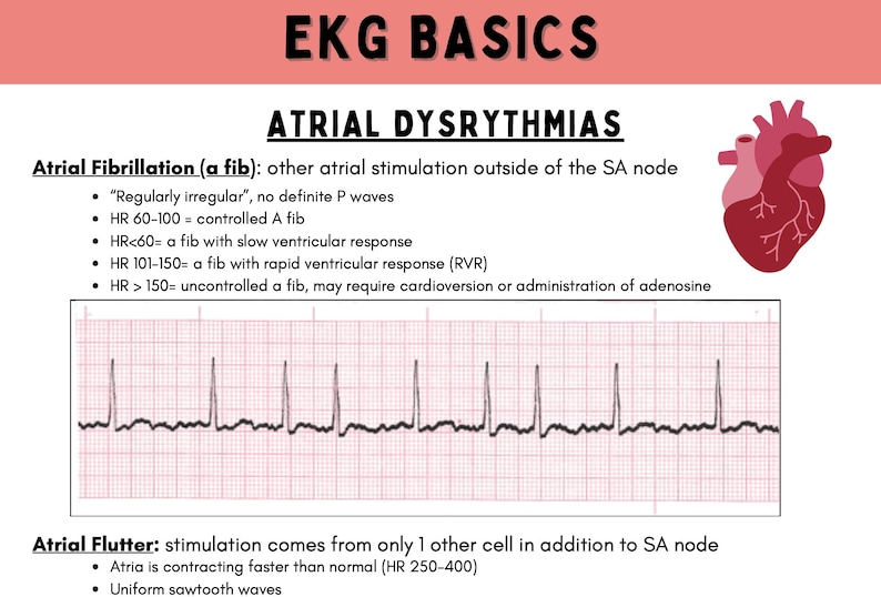 EKG Basics - Etsy