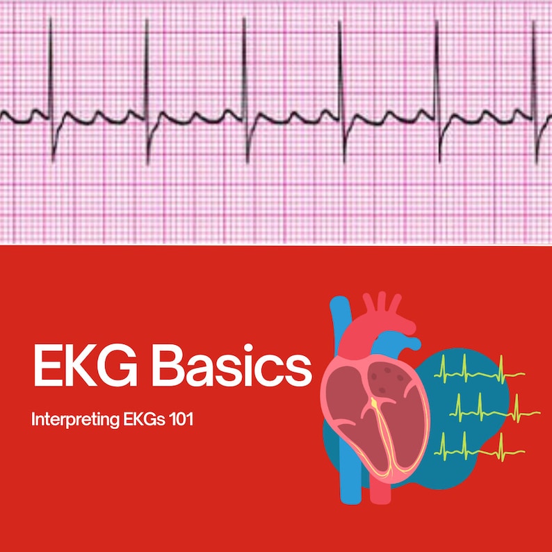 EKG Basics - Etsy