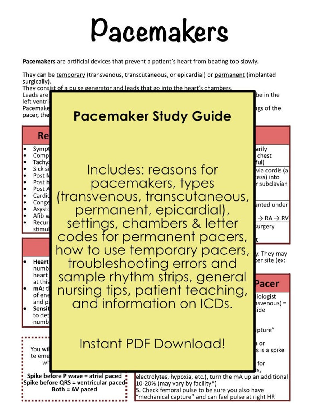 Pacemaker Study Guide - Etsy