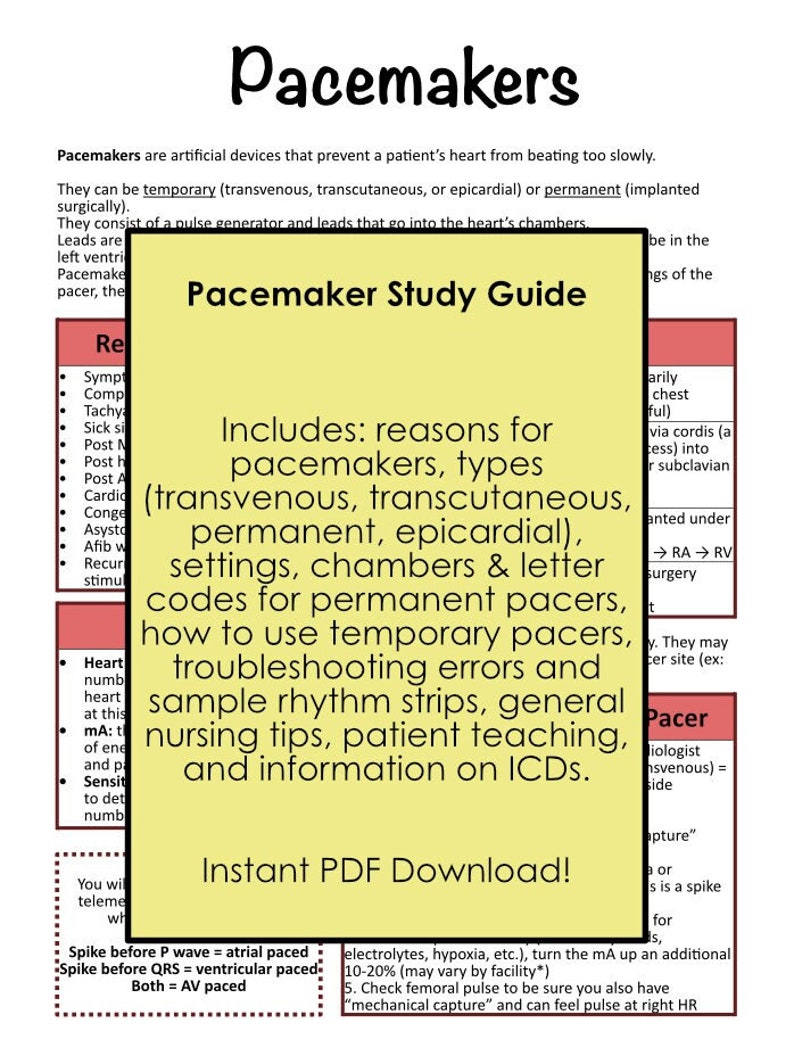 Pacemaker Study Guide - Etsy