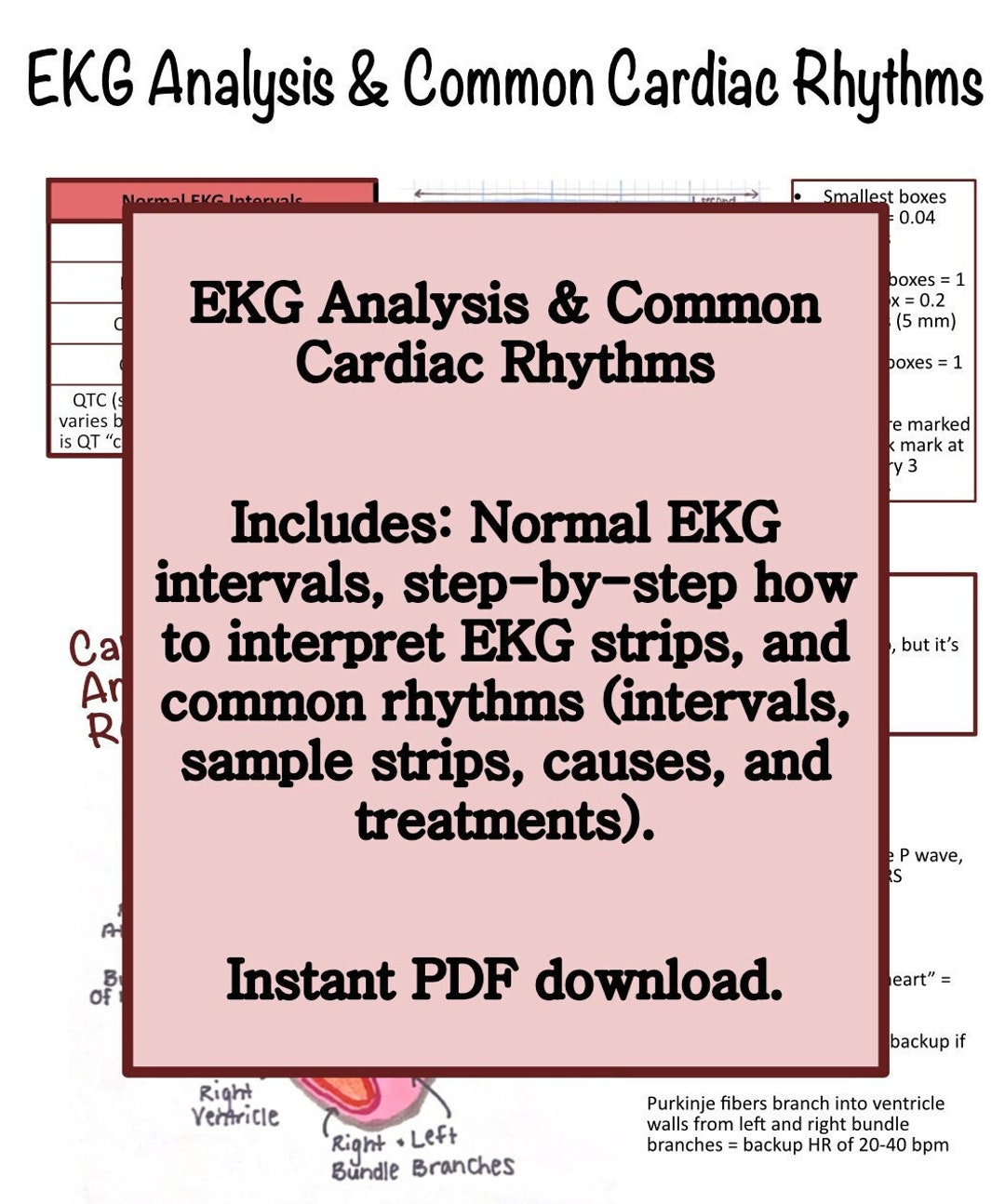 EKG Analysis & Cardiac Rhythm Study Guide - Etsy