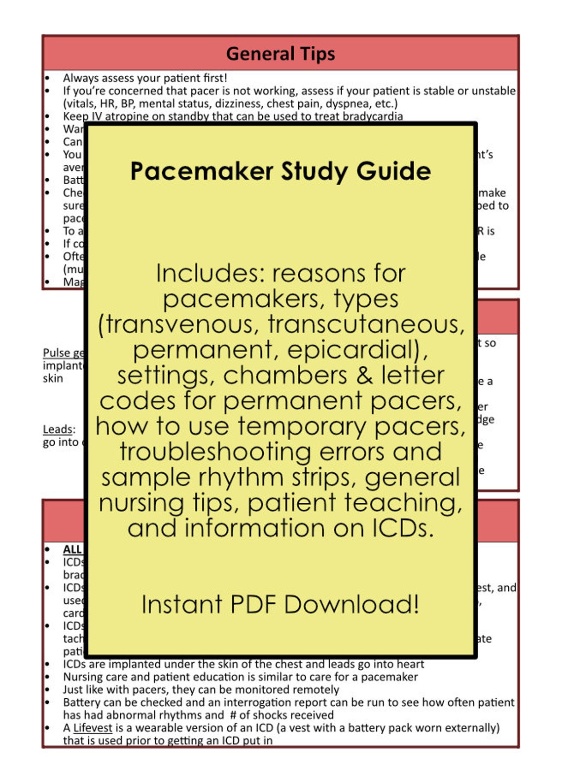 Pacemaker Study Guide - Etsy