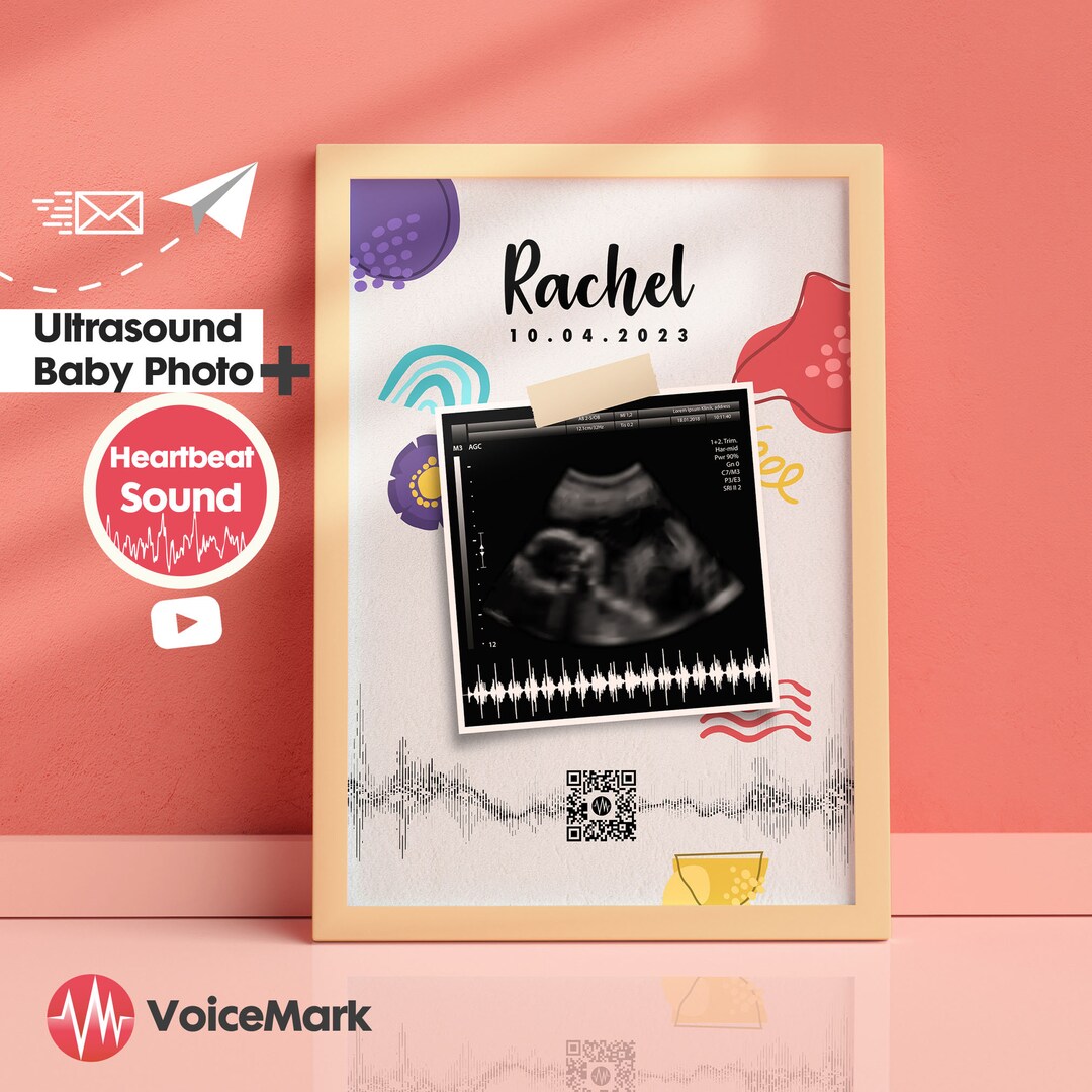Baby Poster Gift, Personalized Ultrasound Photo, Playable Heartbeat ...
