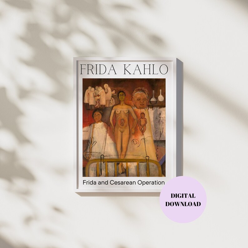 Frida Kahlo 'frida and Cesarean Operation' Art Print (digital Download ...