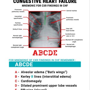 Medical Mnemonics - Etsy