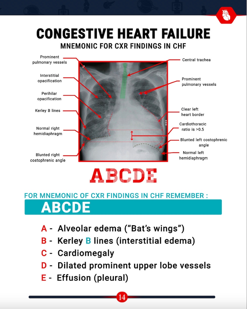 Medical Mnemonics - Etsy