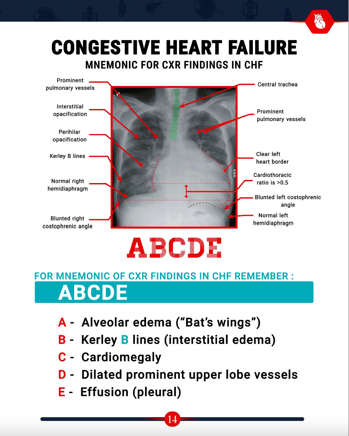 Medical Mnemonics - Etsy