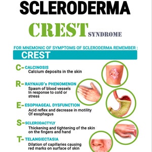 Medical Mnemonics - Etsy