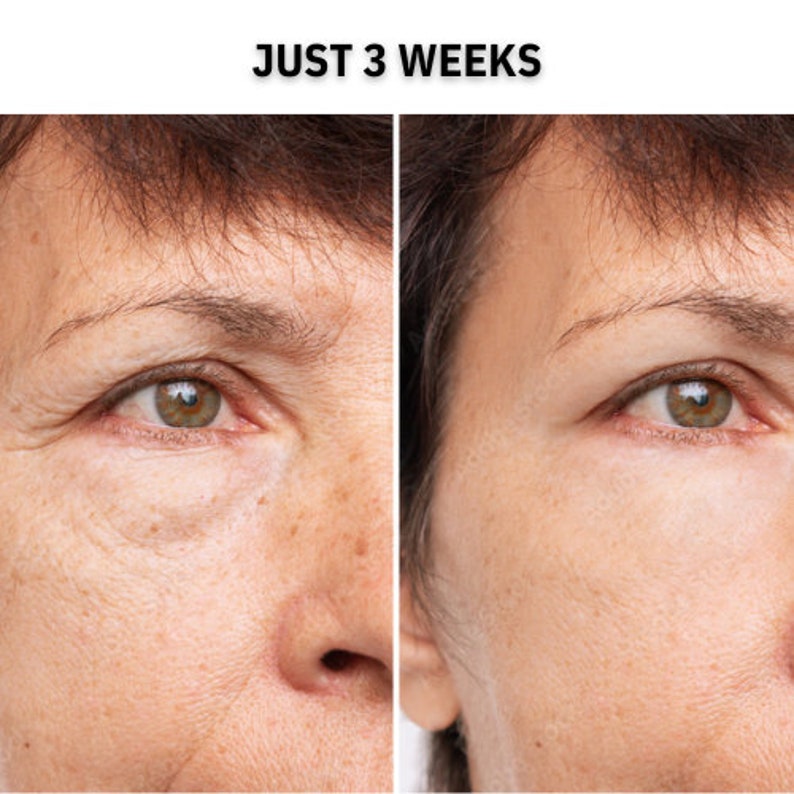 4-in-1 Radiant Therapy Skincare Wand Face Massager With Microcurrent ...