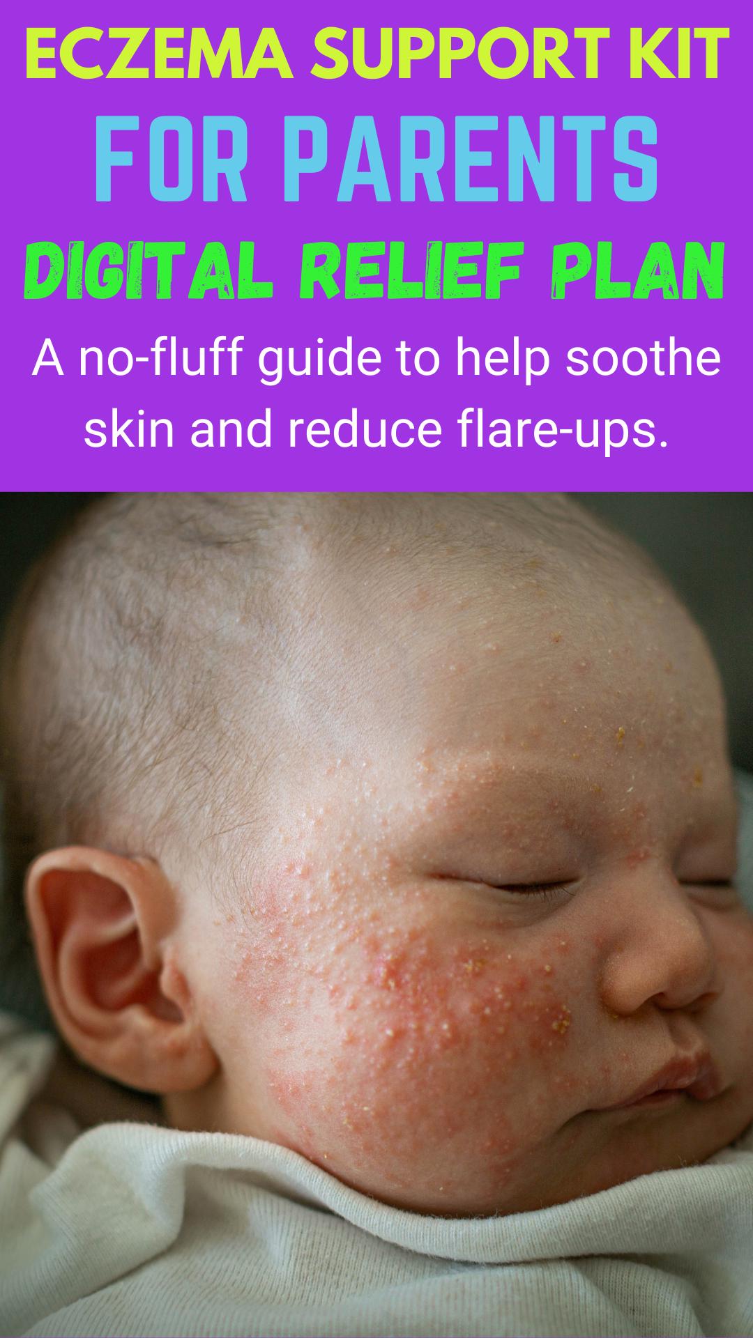 Eczema Relief Kit Guide PDF – Printable Bath Routine, Flare Tracker ...