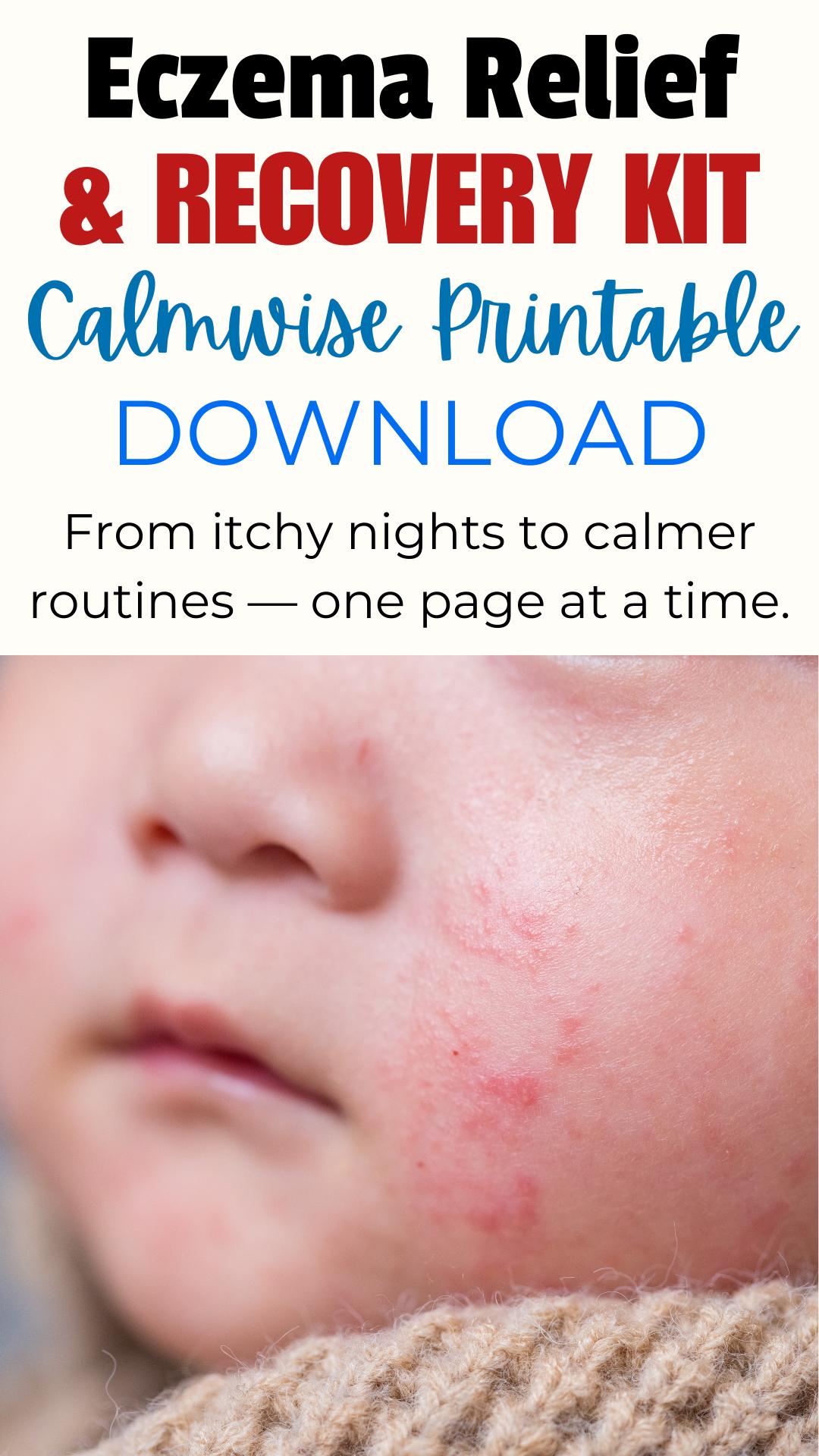 Eczema Relief Kit Guide PDF – Printable Bath Routine, Flare Tracker ...