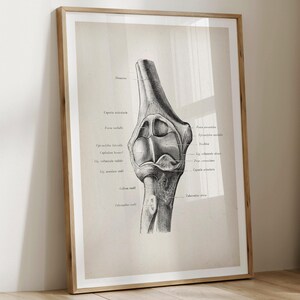 Set 6 Vintage Elbow Anatomy Posters Elbow Joint Diagram Orthopedic Art ...