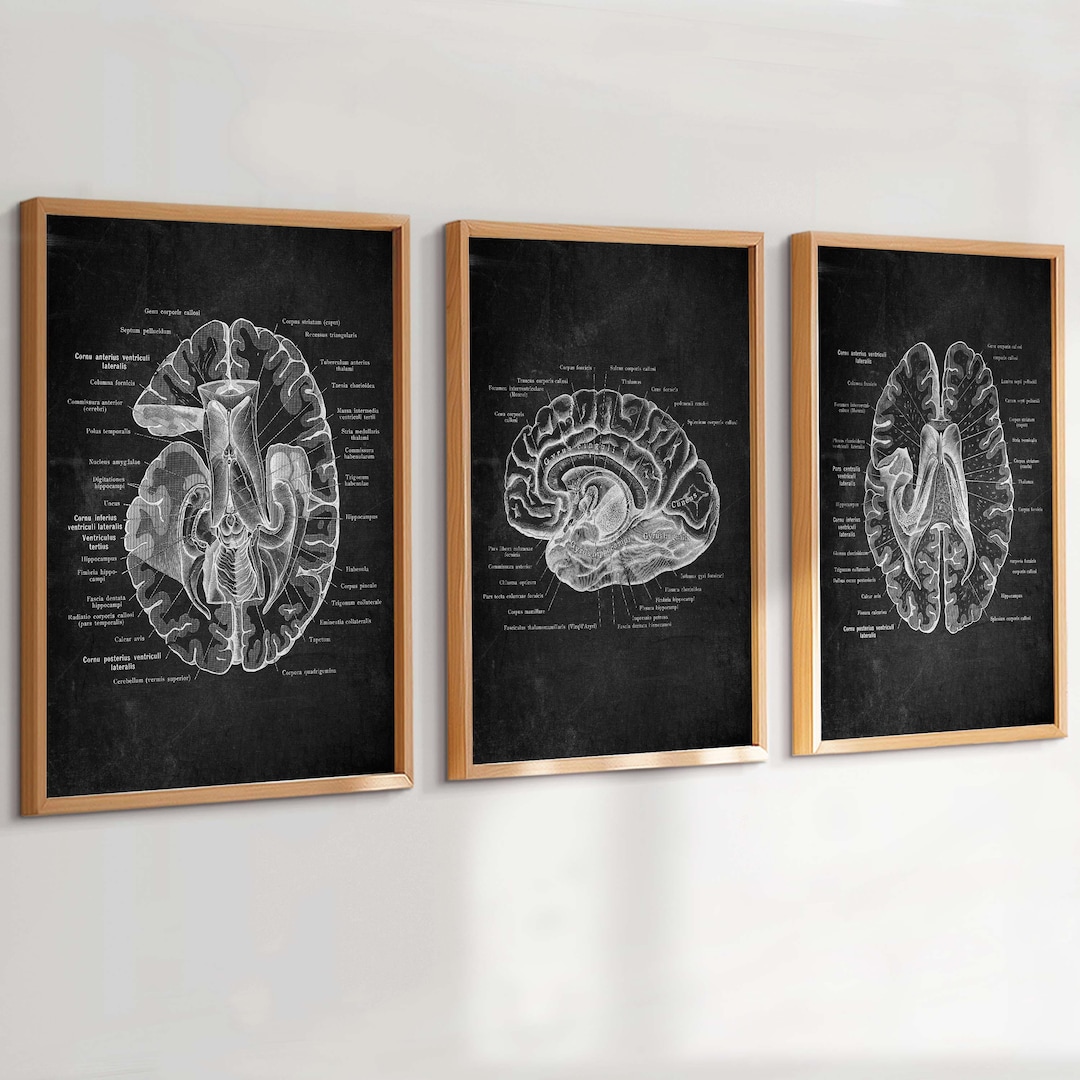 3 Brain Cross Section Anatomy Poster Anatomical Brain Diagram Neurology ...