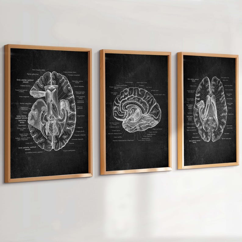 3 Brain Cross Section Anatomy Poster Anatomical Brain Diagram Neurology ...