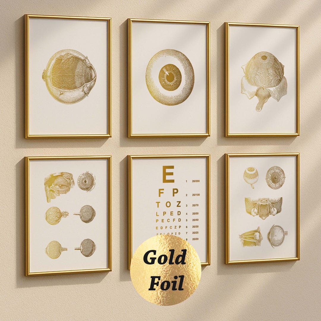 6 Gold Eye Anatomy Art Medical Art Eye Diagnoctic Poster Optometry Art Ophthalmologist Gift Eye ...