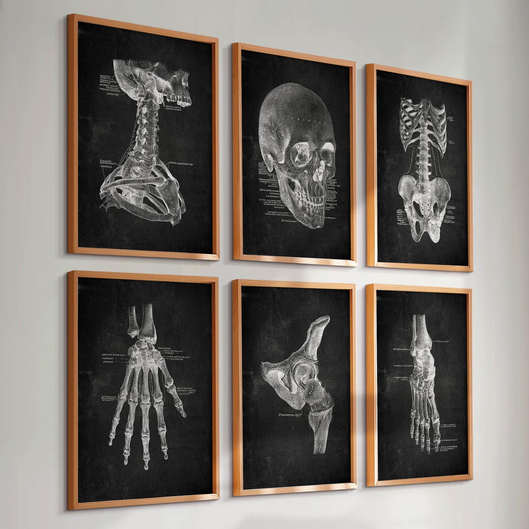 6 Skeleton Anatomy Prints Chalkboard Art Skeletal System Art Orthopedic ...
