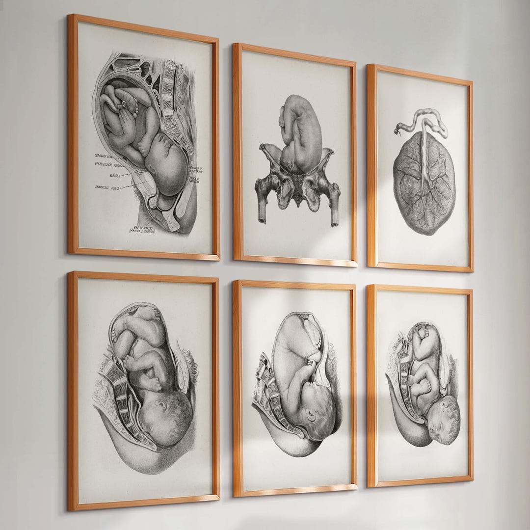 6 Vintage Pregnancy Anatomy Posters Childbirth Art Fetus in Womb Print ...