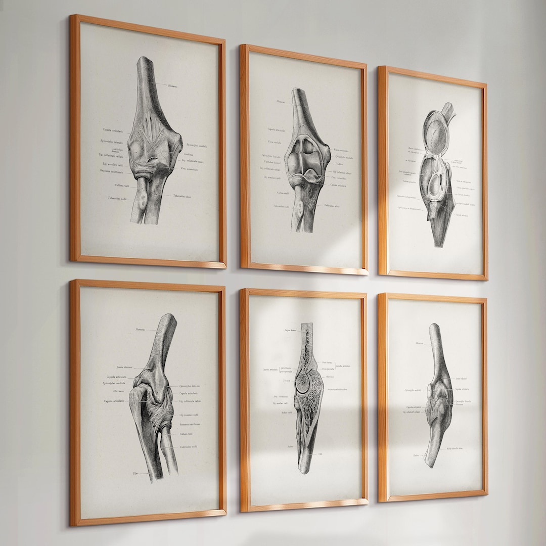 Set 6 Vintage Elbow Anatomy Posters Elbow Joint Diagram Orthopedic Art ...