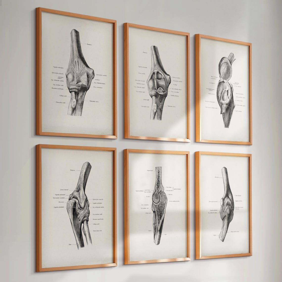 Set 6 Vintage Elbow Anatomy Posters Elbow Joint Diagram Orthopedic Art ...