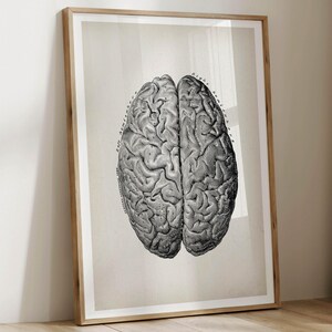 6 Vintage Brain Anatomy Prints Neuroanatomy Art Neuroscience Art ...