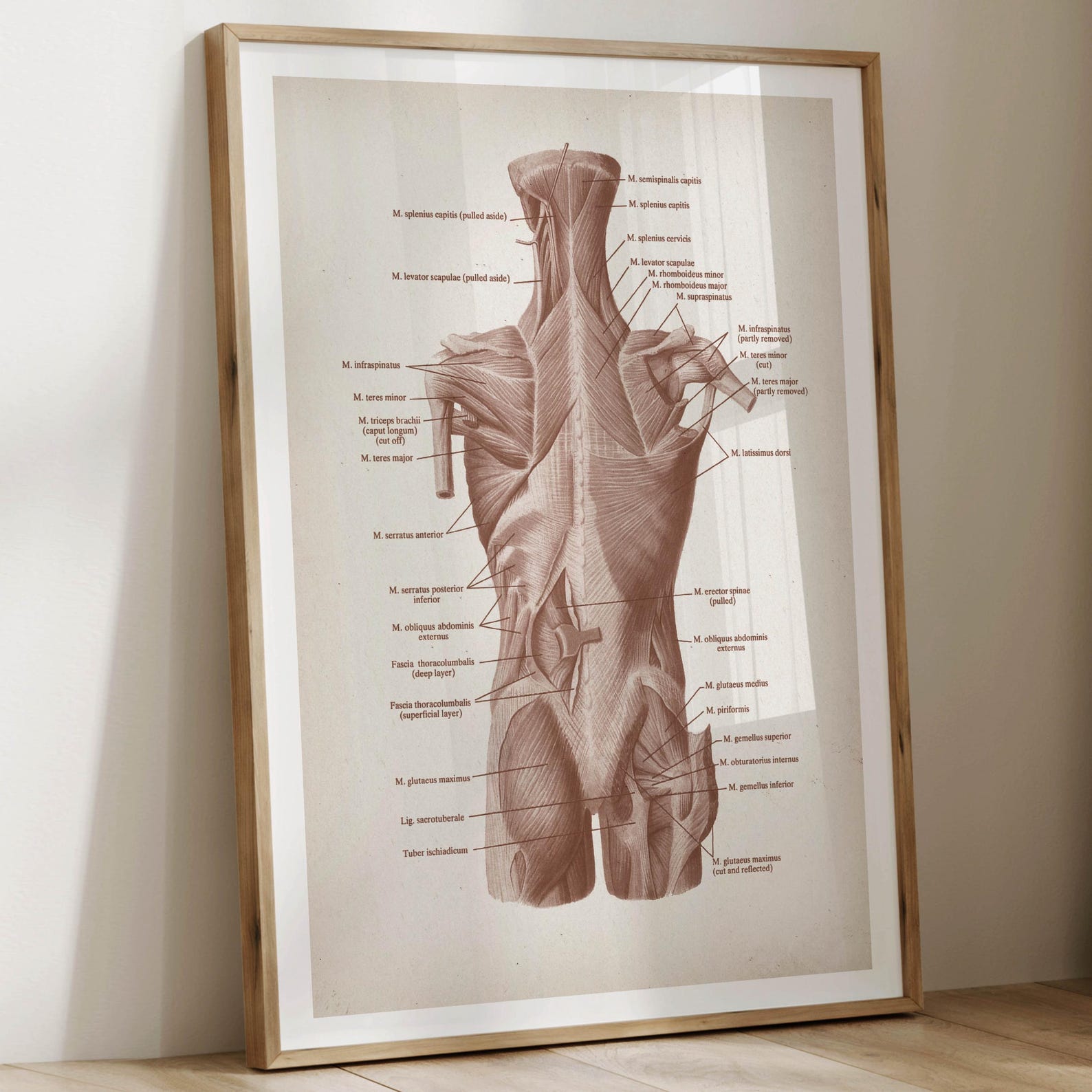 Set 6 Vintage Surgical Anatomy Art Musculoskeletal System Posters ...