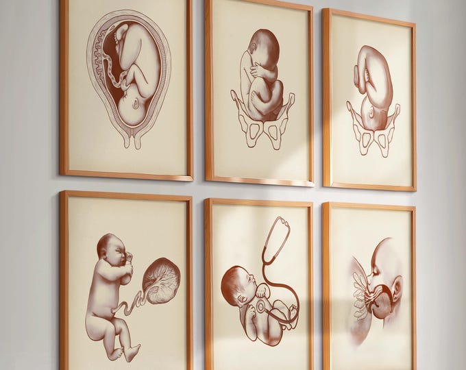 1865 Childbirth, Antique Obstetrics Print, Anatomy Embryology ...