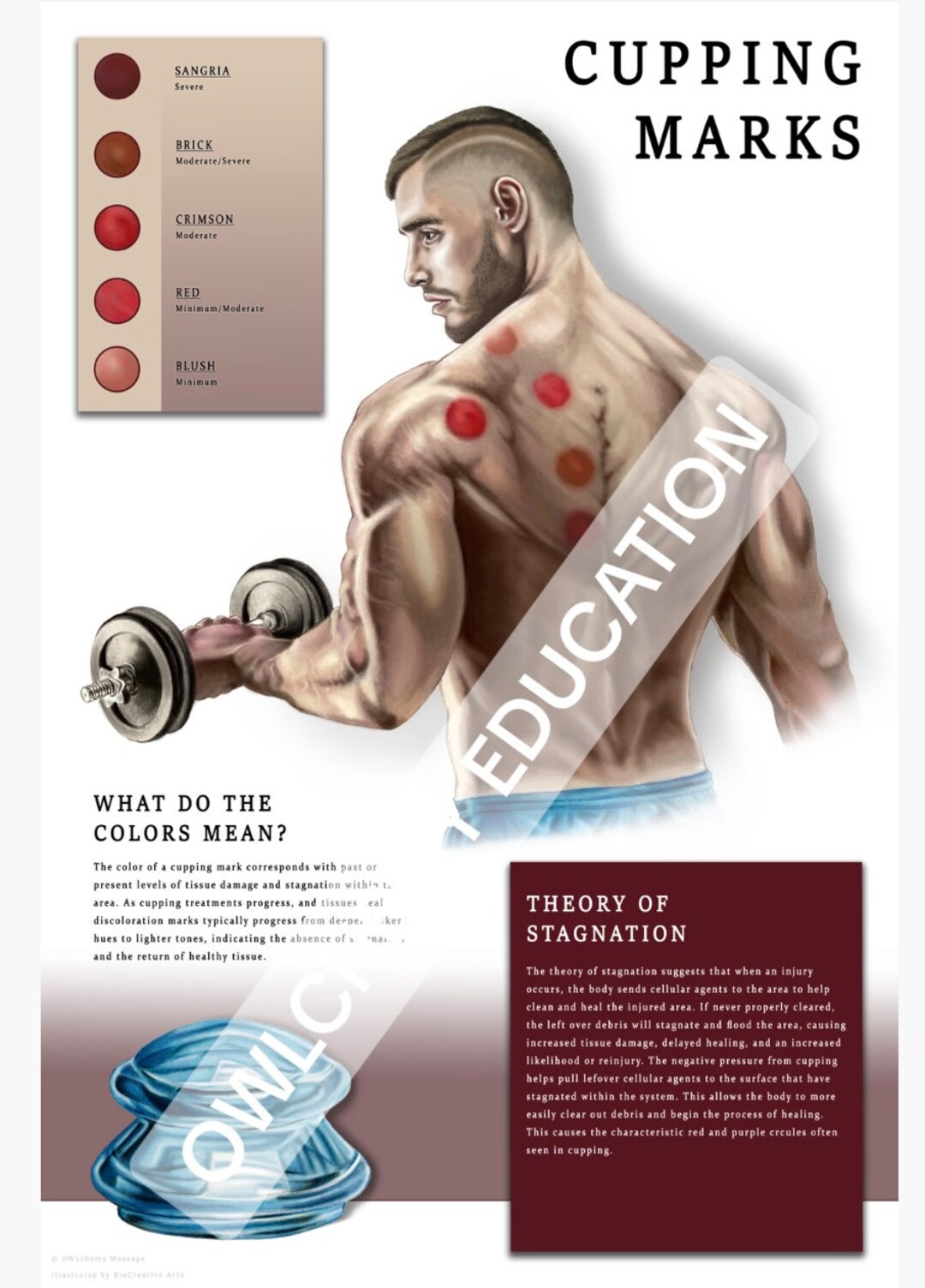 Laminated 18x24 Cupping Marks Poster - Etsy