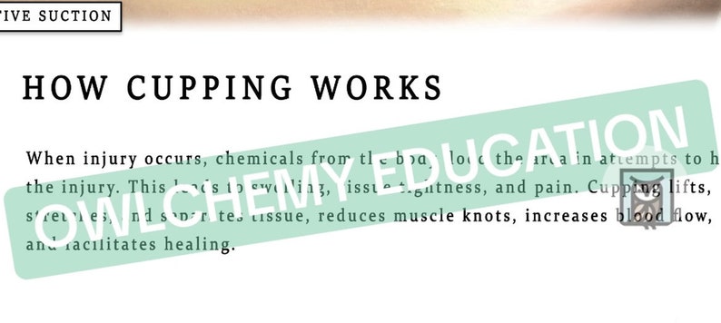 18x24 Laminate What is Cupping Poster - Etsy