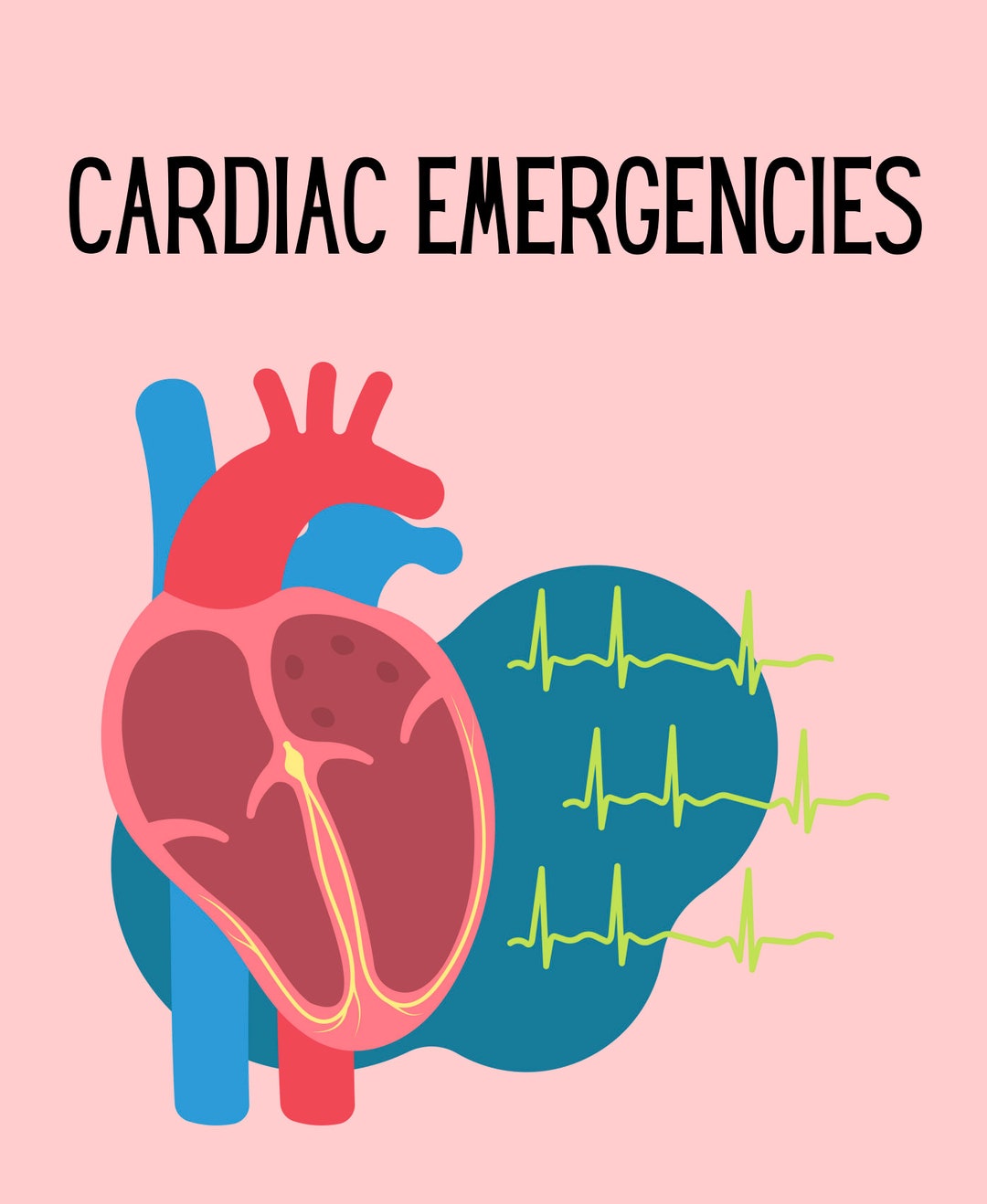 Cardiac Emergencies Mastery: Visual Nursing Notes for Students, New ...