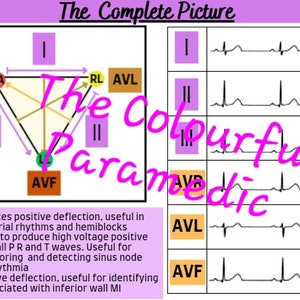 The Three Lead ECG Guide Part One - Etsy