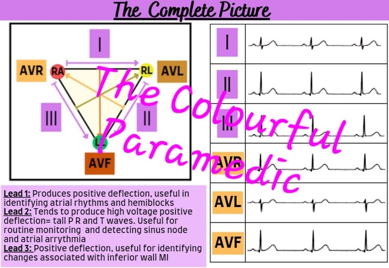 The Three Lead ECG Guide Part One - Etsy