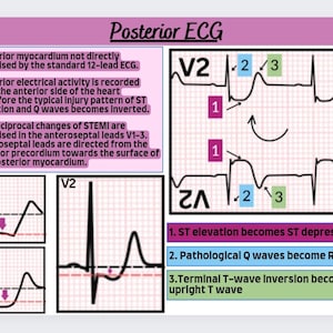 12 Lead ECG Colourful Guide - Etsy