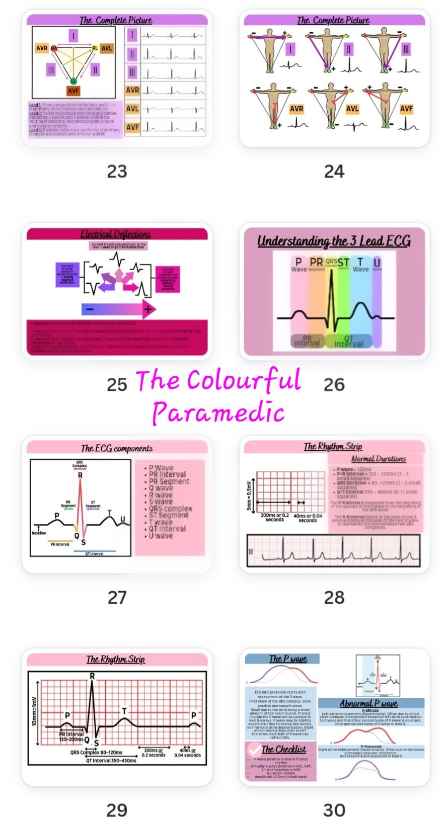 The Three Lead ECG Guide Part One - Etsy
