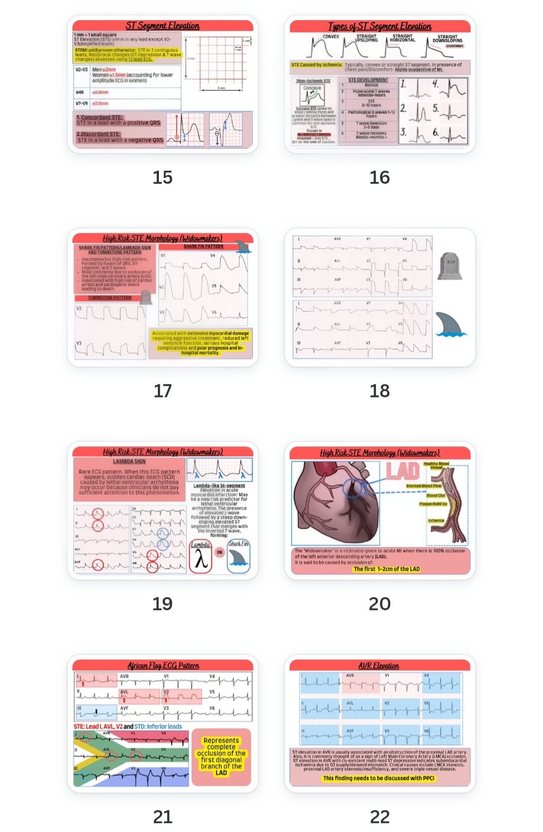 12 Lead ECG Colourful Guide - Etsy