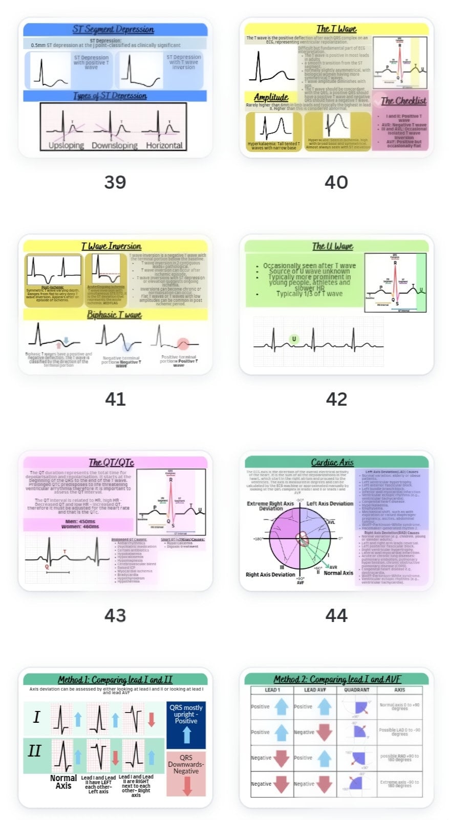 The Three Lead ECG Guide Part One - Etsy UK