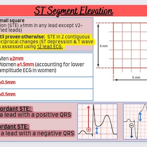 12 Lead ECG Colourful Guide - Etsy