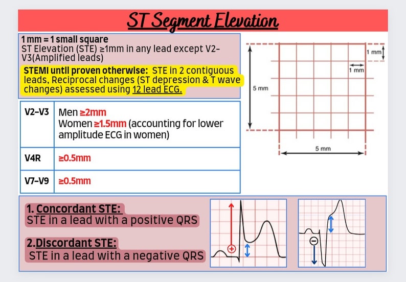12 Lead ECG Colourful Guide - Etsy