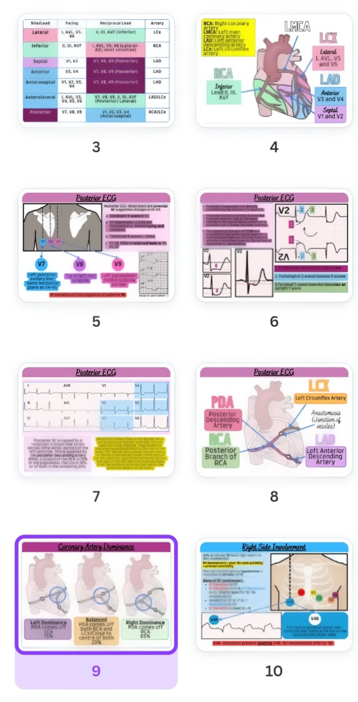 12 Lead ECG Colourful Guide - Etsy