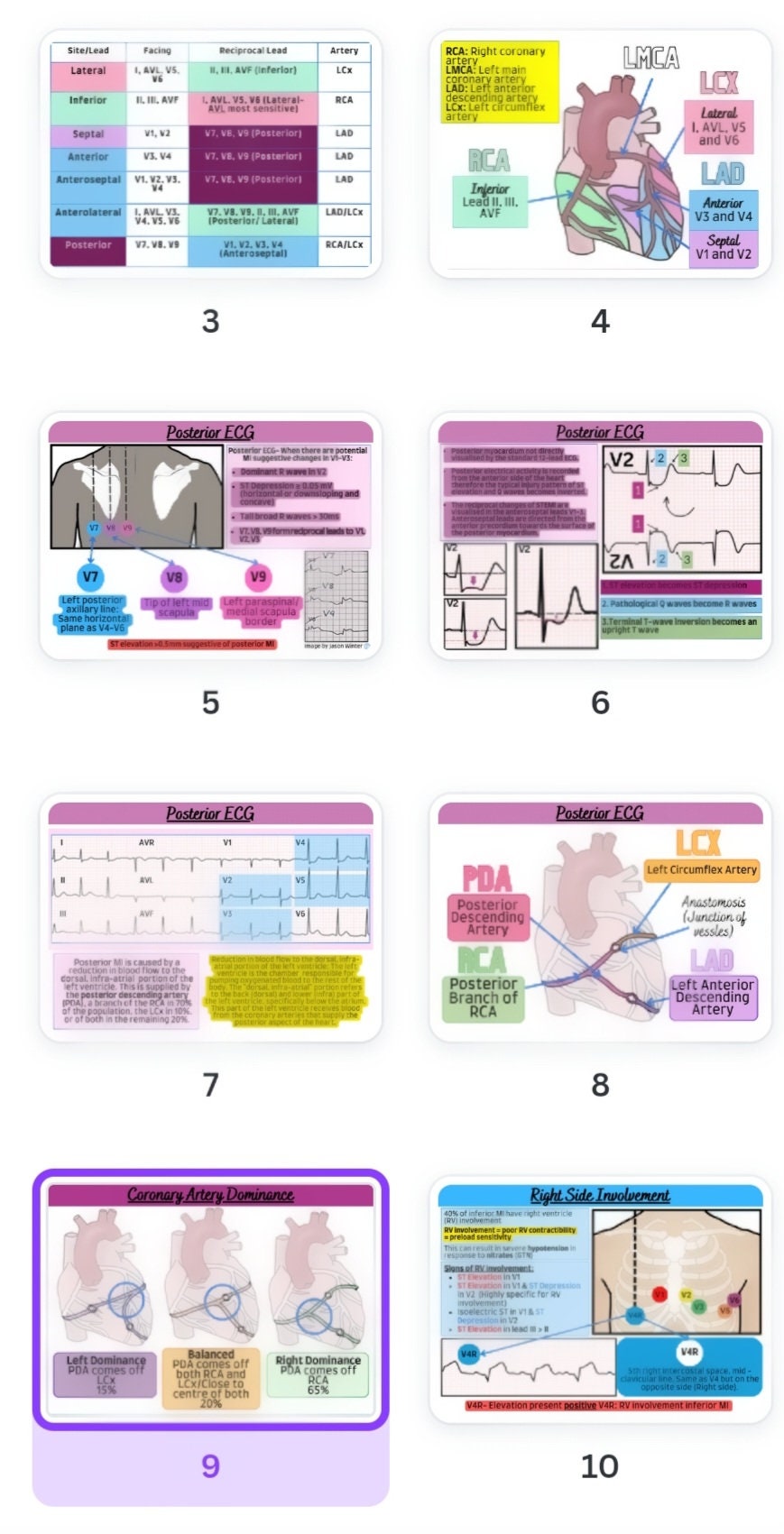 12 Lead ECG Colourful Guide - Etsy