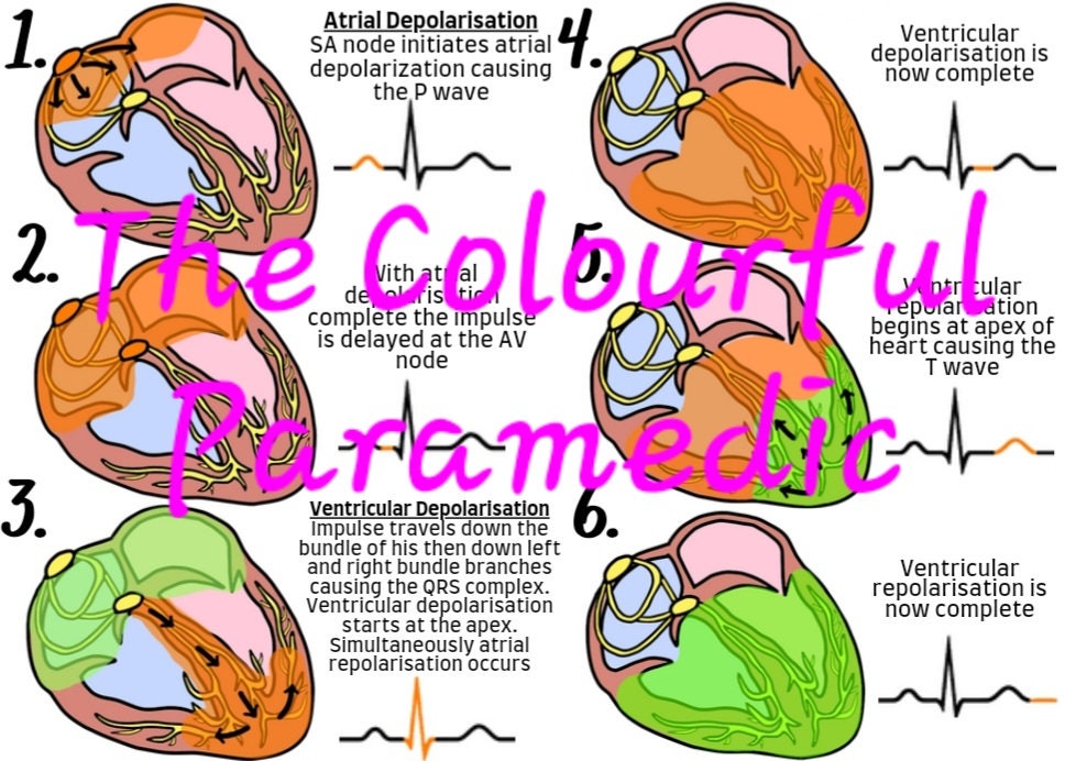 The Three Lead ECG Guide Part One - Etsy