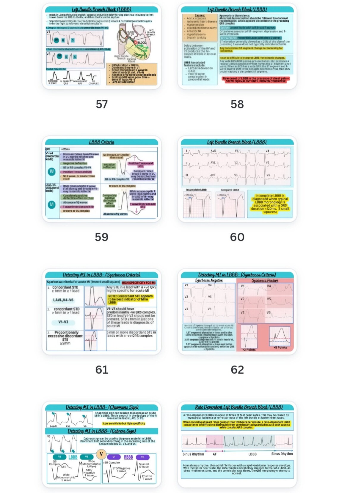 12 Lead ECG Colourful Guide - Etsy