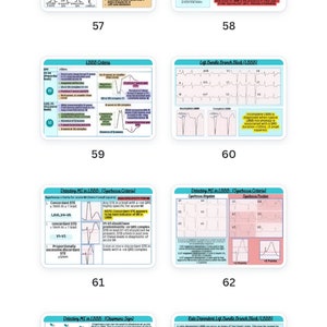 12 Lead ECG Colourful Guide - Etsy