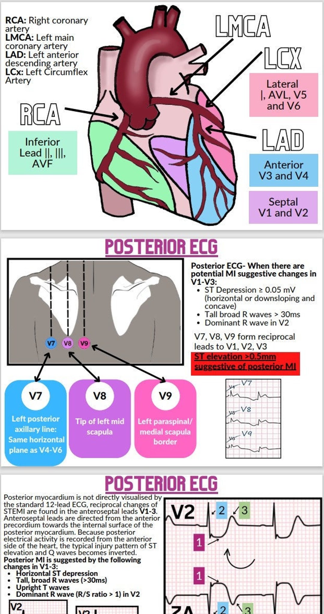 The Colourful 12 Lead ECG Guide - Etsy UK