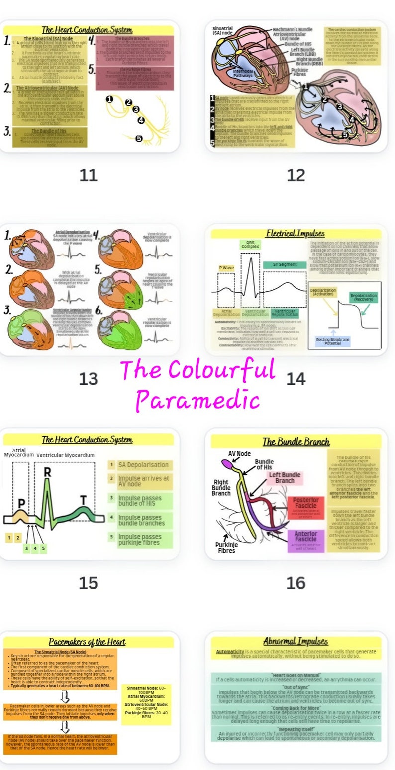 The Three Lead ECG Guide Part One - Etsy