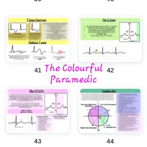 The Three Lead ECG Guide Part One - Etsy