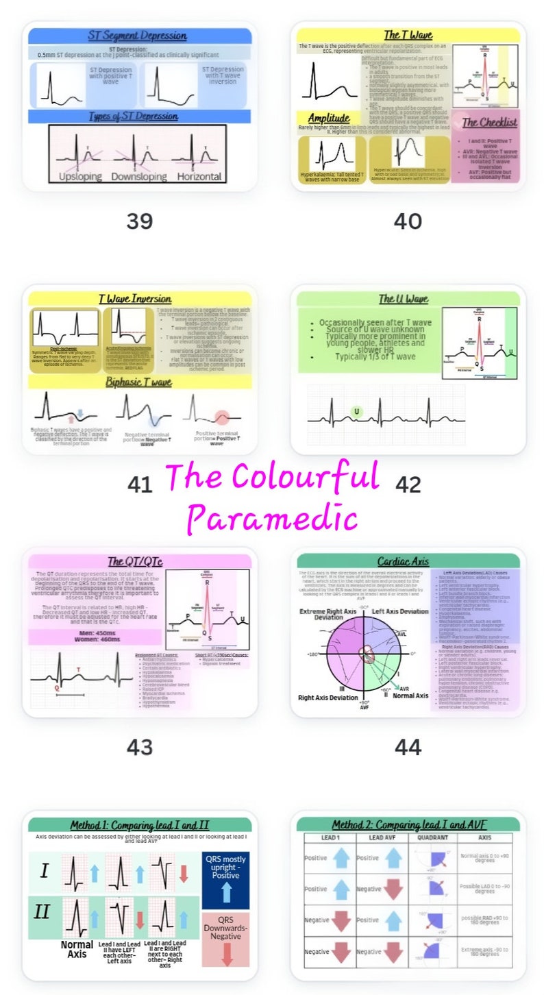 The Three Lead ECG Guide Part One - Etsy