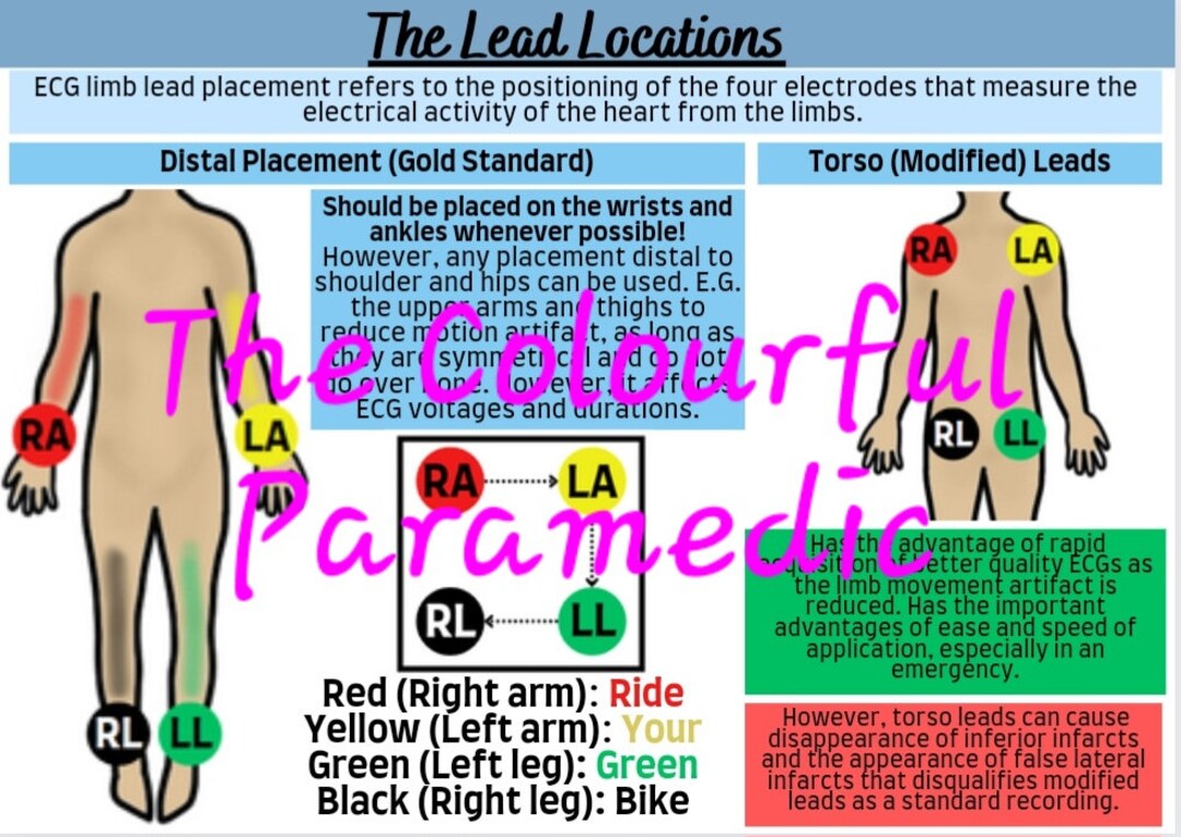 The Three Lead ECG Guide Part One - Etsy