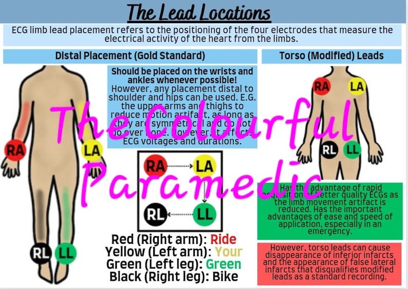 The Three Lead ECG Guide Part One - Etsy