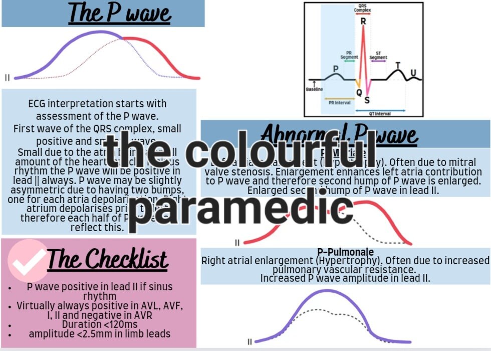 The Three Lead ECG Guide Part One - Etsy UK