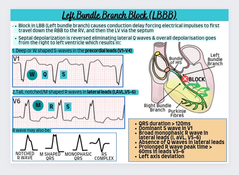 12 Lead ECG Colourful Guide - Etsy
